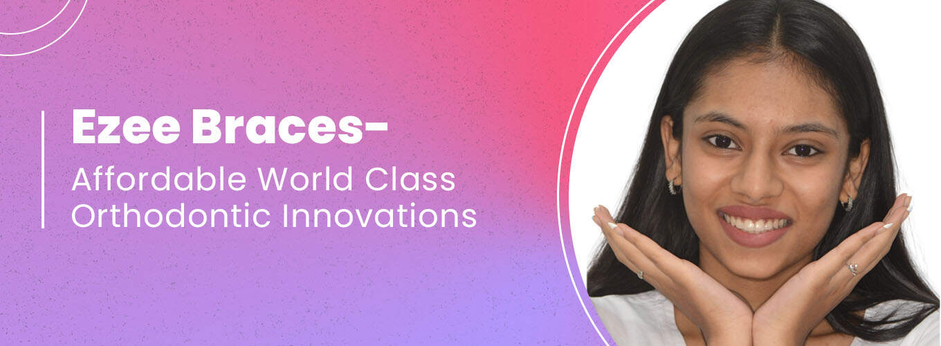 BaTR: The Advanced Orthodontic Bracket System